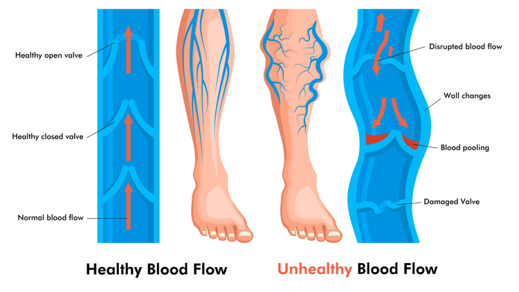 Pregnancy Compression Socks – Maternity Yard