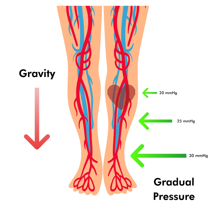 Pregnancy Compression Socks – Maternity Yard