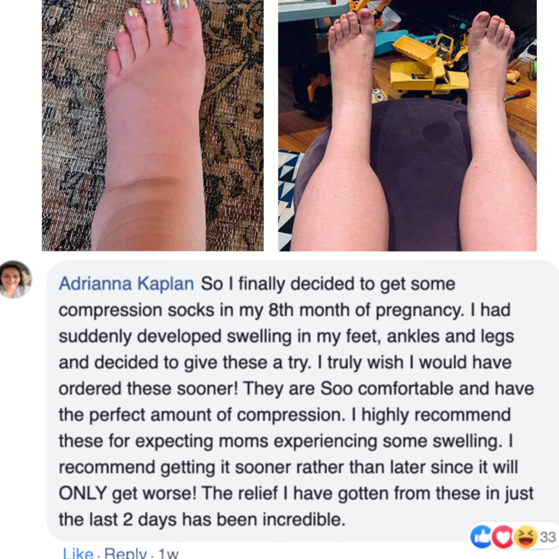 Pregnancy Compression Socks – Maternity Yard